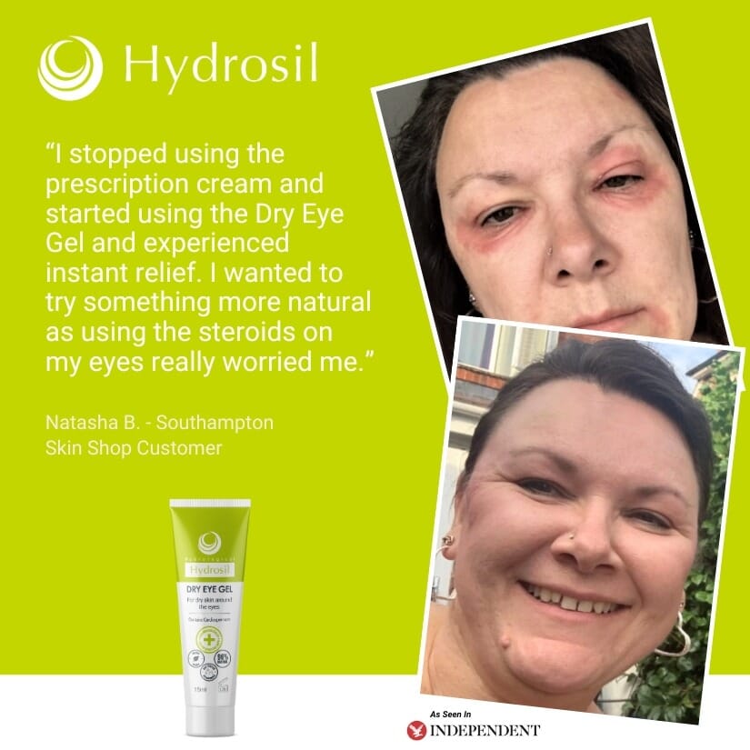 Hydrosil Dry Eye Gel | Gel for Eye Eczema | Skin Shop