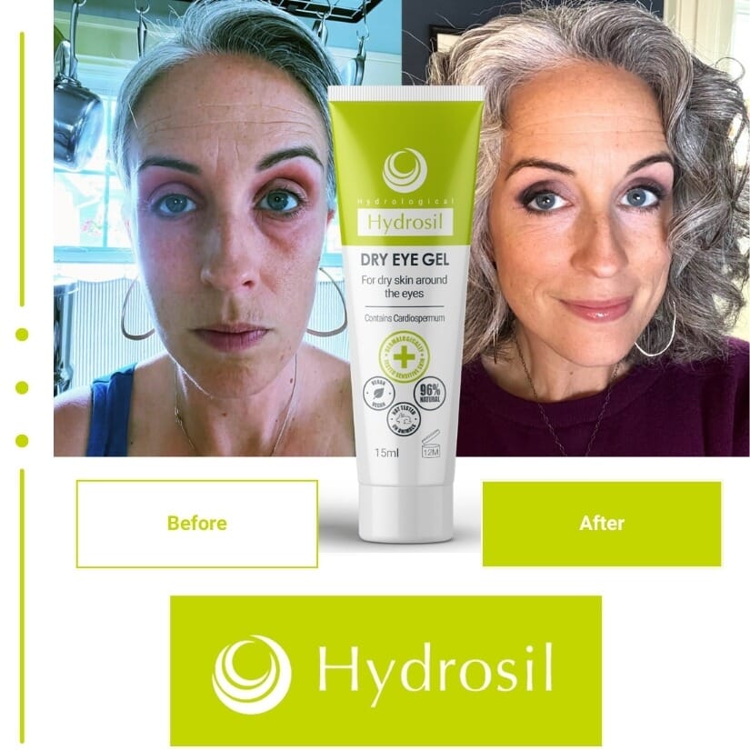 Hydrosil Dry Eye Gel | Gel for Eye Eczema | Skin Shop