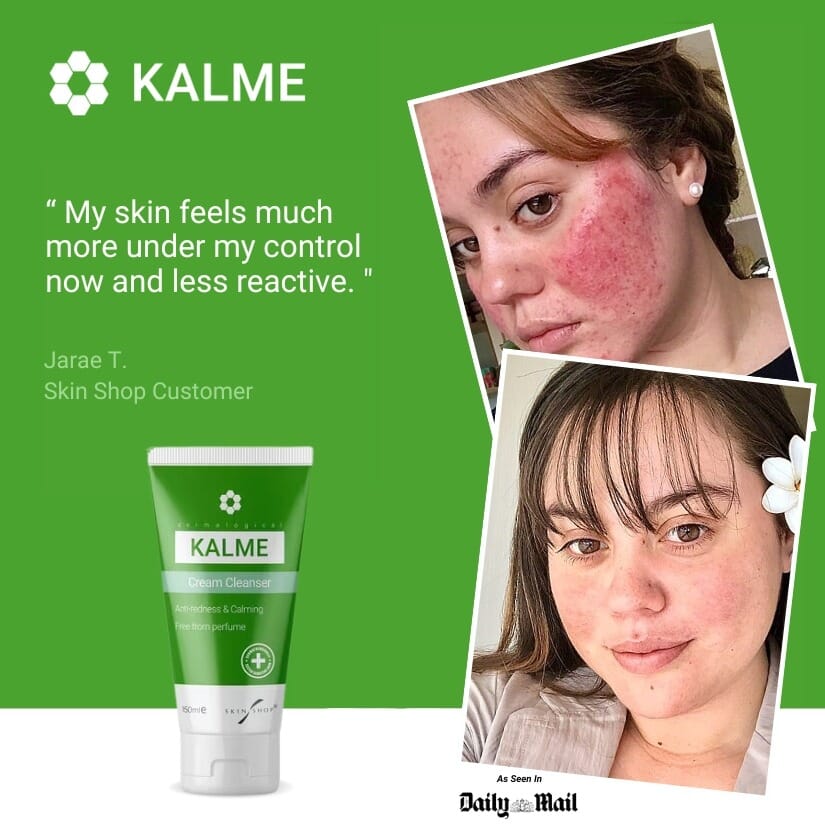 Kalme Cream Cleanser | Moisturiser for Rosacea | Skin Shop