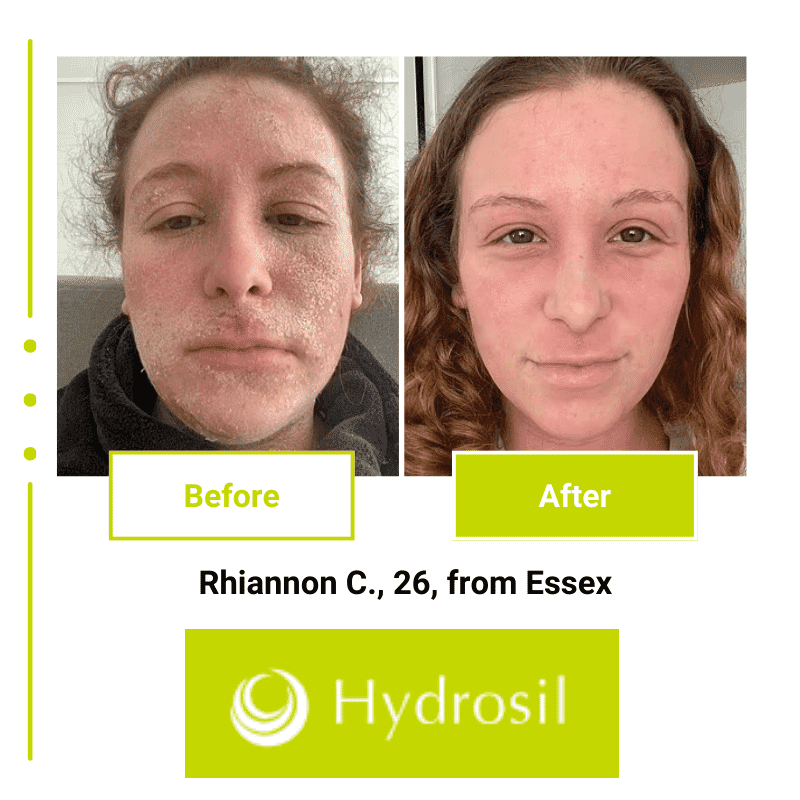 Hydrosil Routine - Black Friday - 50% Off