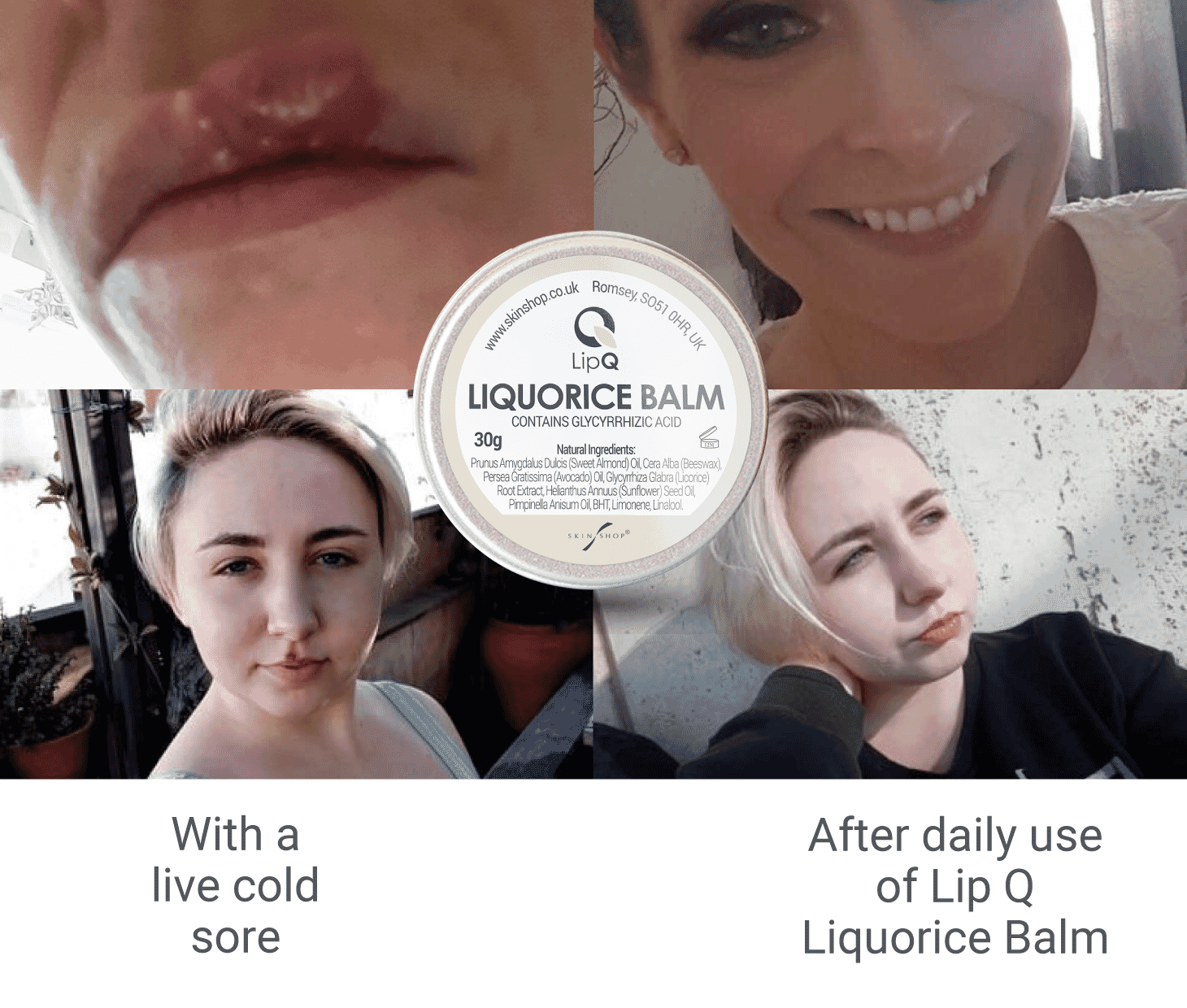 Solutions to prevent cold sores